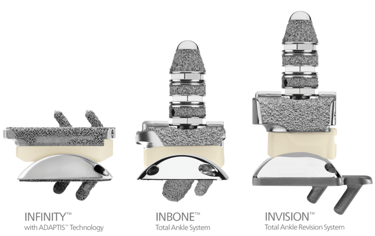 Total Ankle Replacement - Panorama Orthopedics