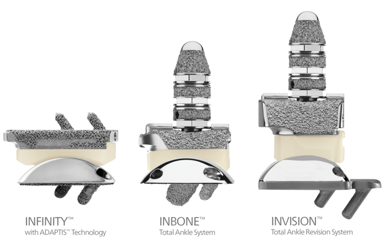 Total Ankle Replacement - Panorama Orthopedics